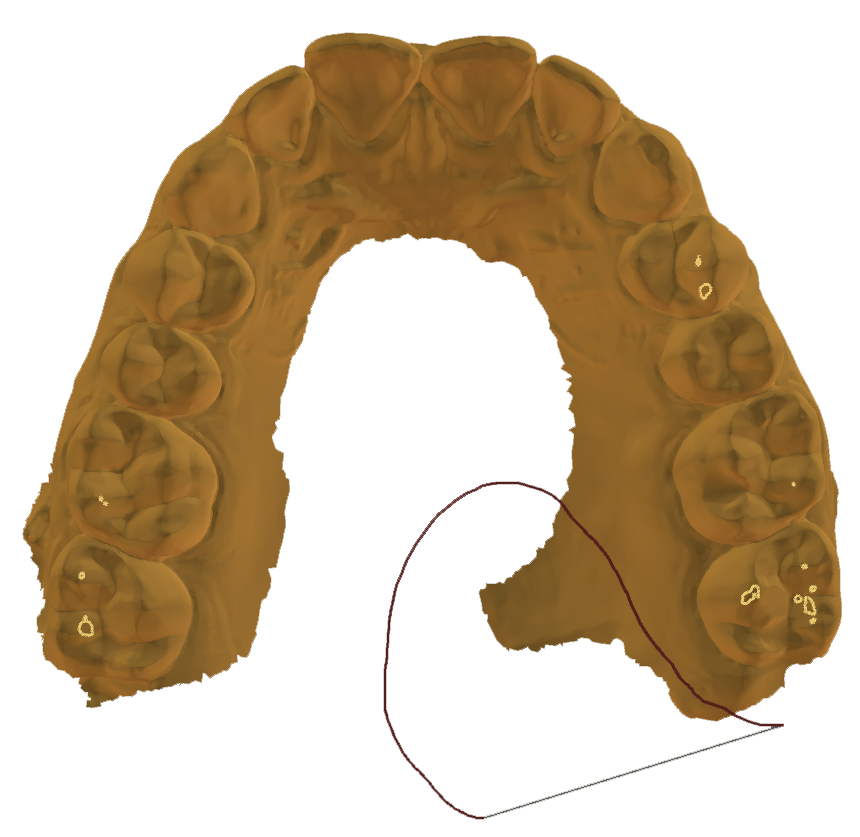 ArchForm - Simple, powerful 3D software to setup aligner cases